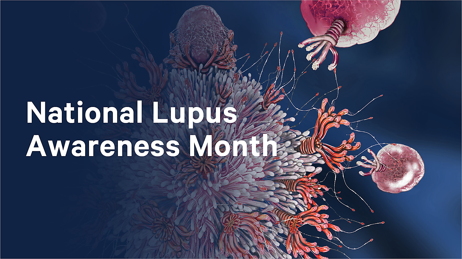 Bridging the genome and transcriptome in study of lupus immune ...