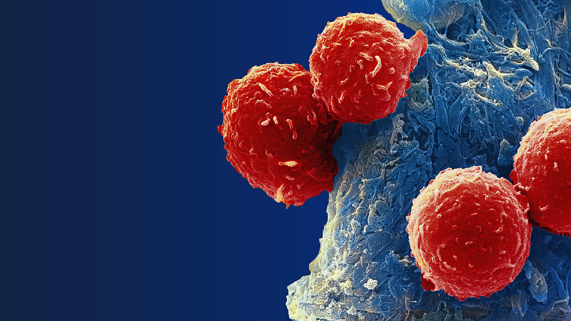 SITC 2022 recap: Single cell, spatial, and in situ tools for cancer immunotherapy research - 10x ...