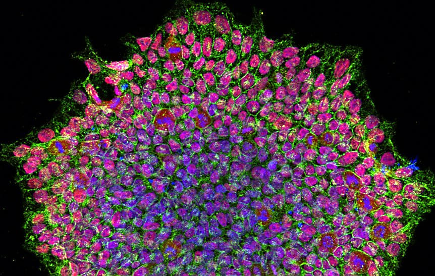 Organoids bring drug discovery and development to the culture hood ...