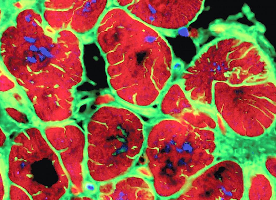 A single cell and spatial map of how the heart heals - 10x Genomics