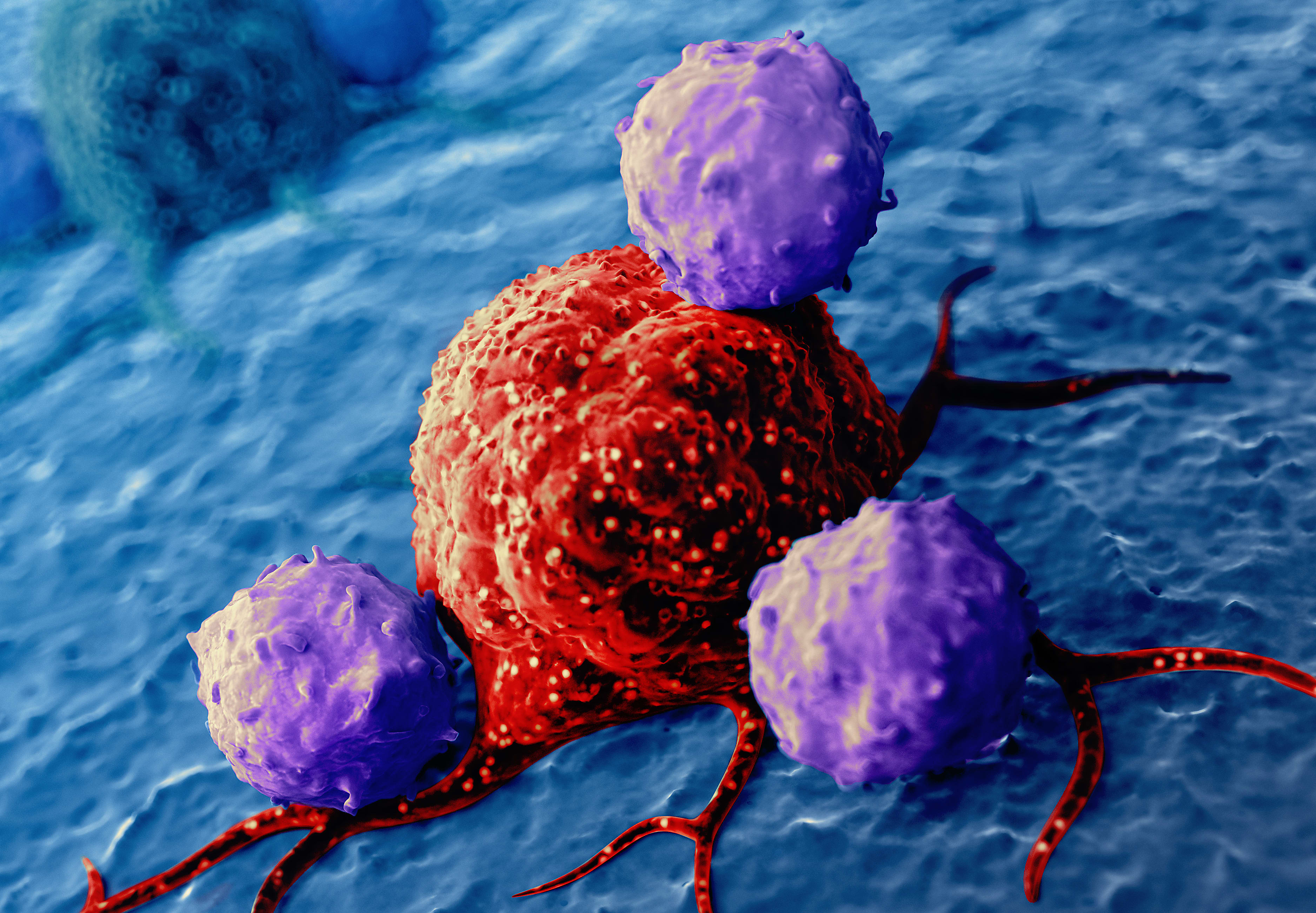 Immunotherapy impacts: Moving the needle on pediatric glioma and rare ...