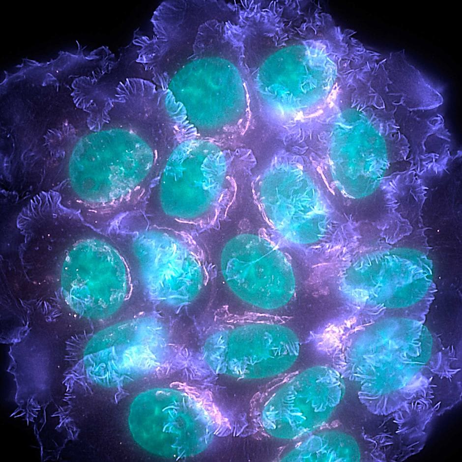 State of the field: Key publications describe how single cell and ...