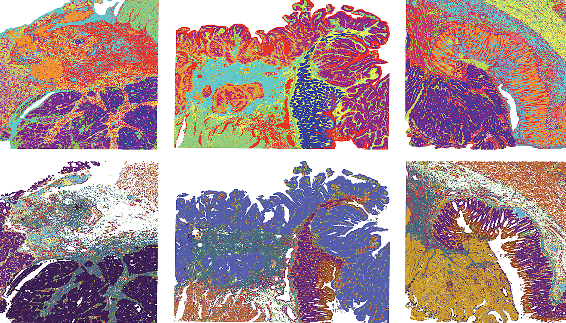 How mapping the spatial biology of the tumor microenvironment can ...