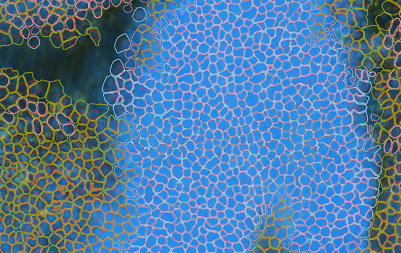 Xenium software improvements that make single cell spatial imaging ...