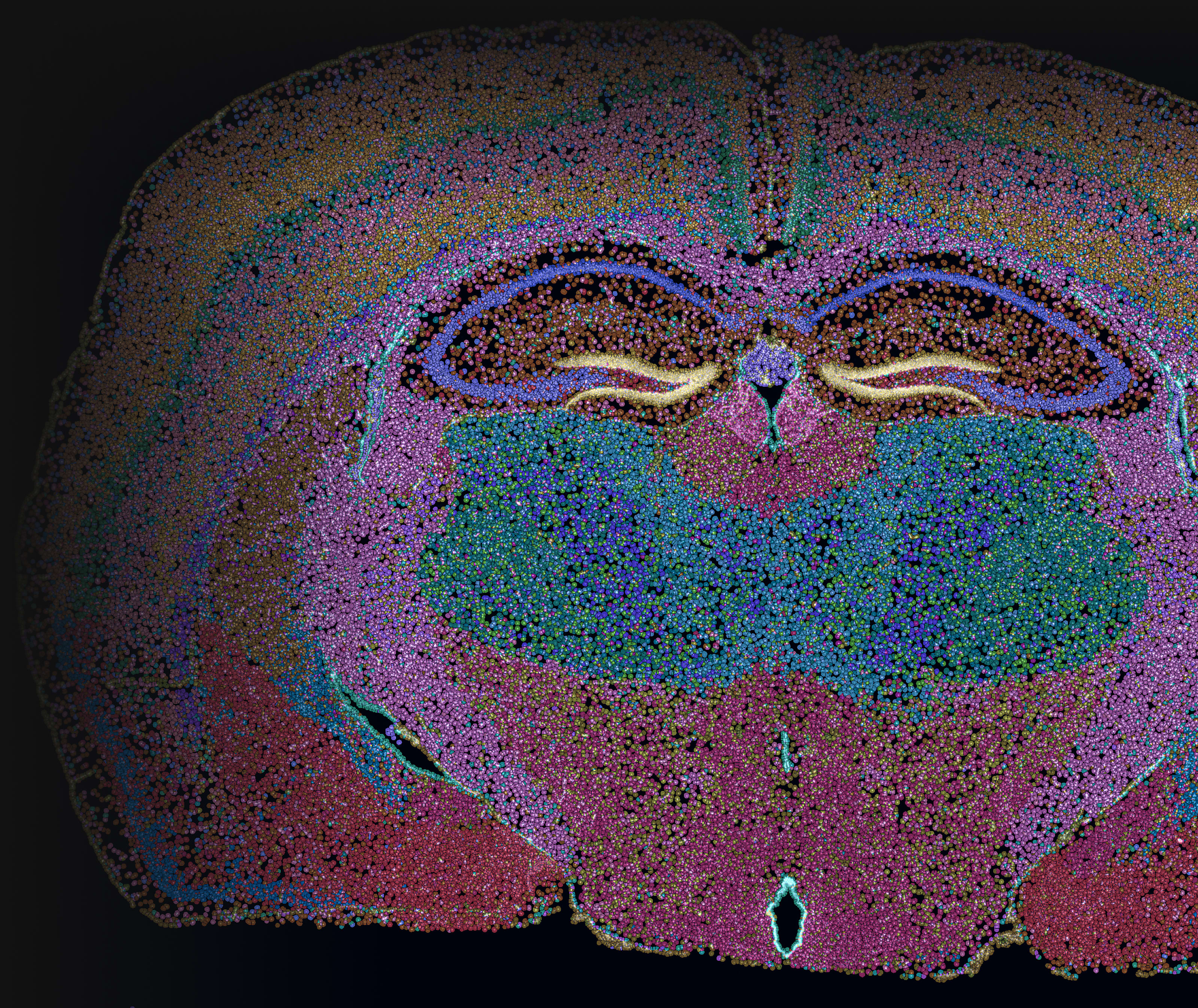 Spatially resolved transcriptomics: An introductory overview of spatial gene expression ...