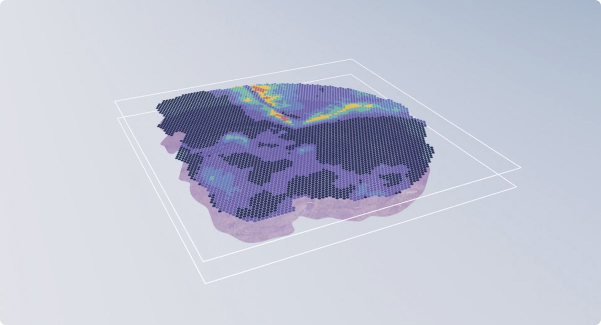 Simplifying Spatial Transcriptomics Protocols With Visium Cytassist