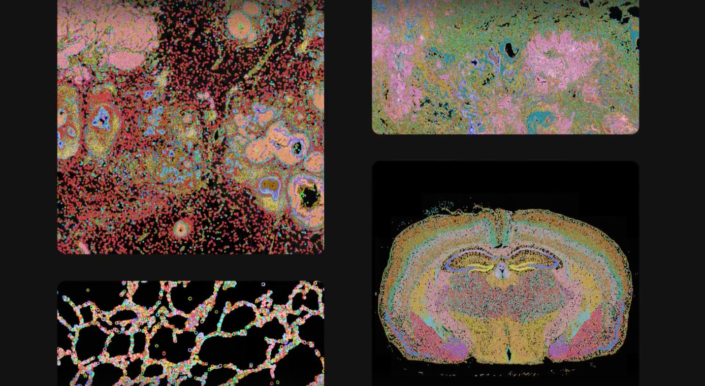 Answering your questions about Xenium In Situ: Spotlight on getting ...