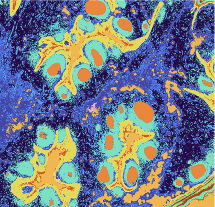 Visium Spatial Platform - 10x Genomics
