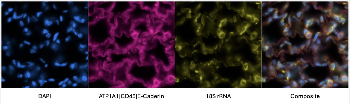 Boundary stain shows cell morphology better than the interior stain