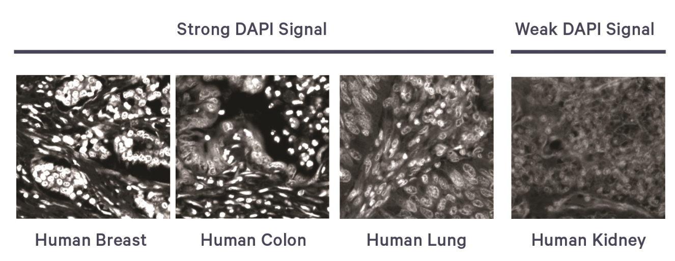 What should I consider when processing Human Brain on Xenium?