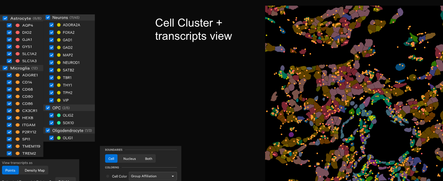 What should I consider when processing Human Brain on Xenium?