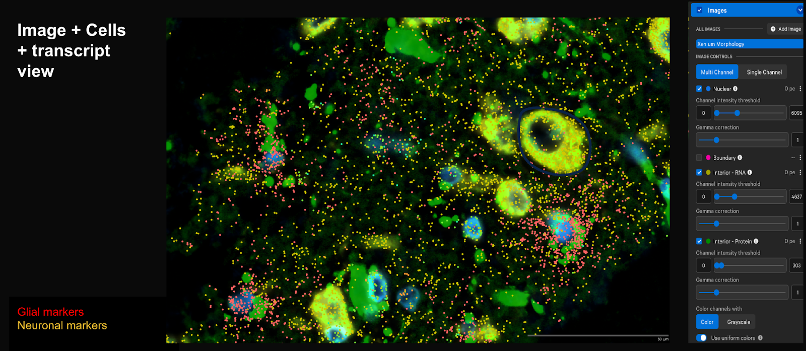 What should I consider when processing Human Brain on Xenium?