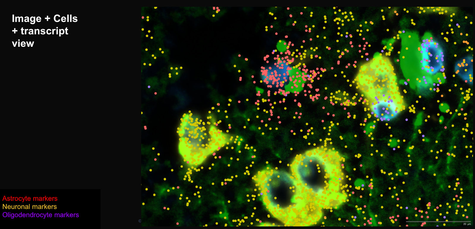 What should I consider when processing Human Brain on Xenium?
