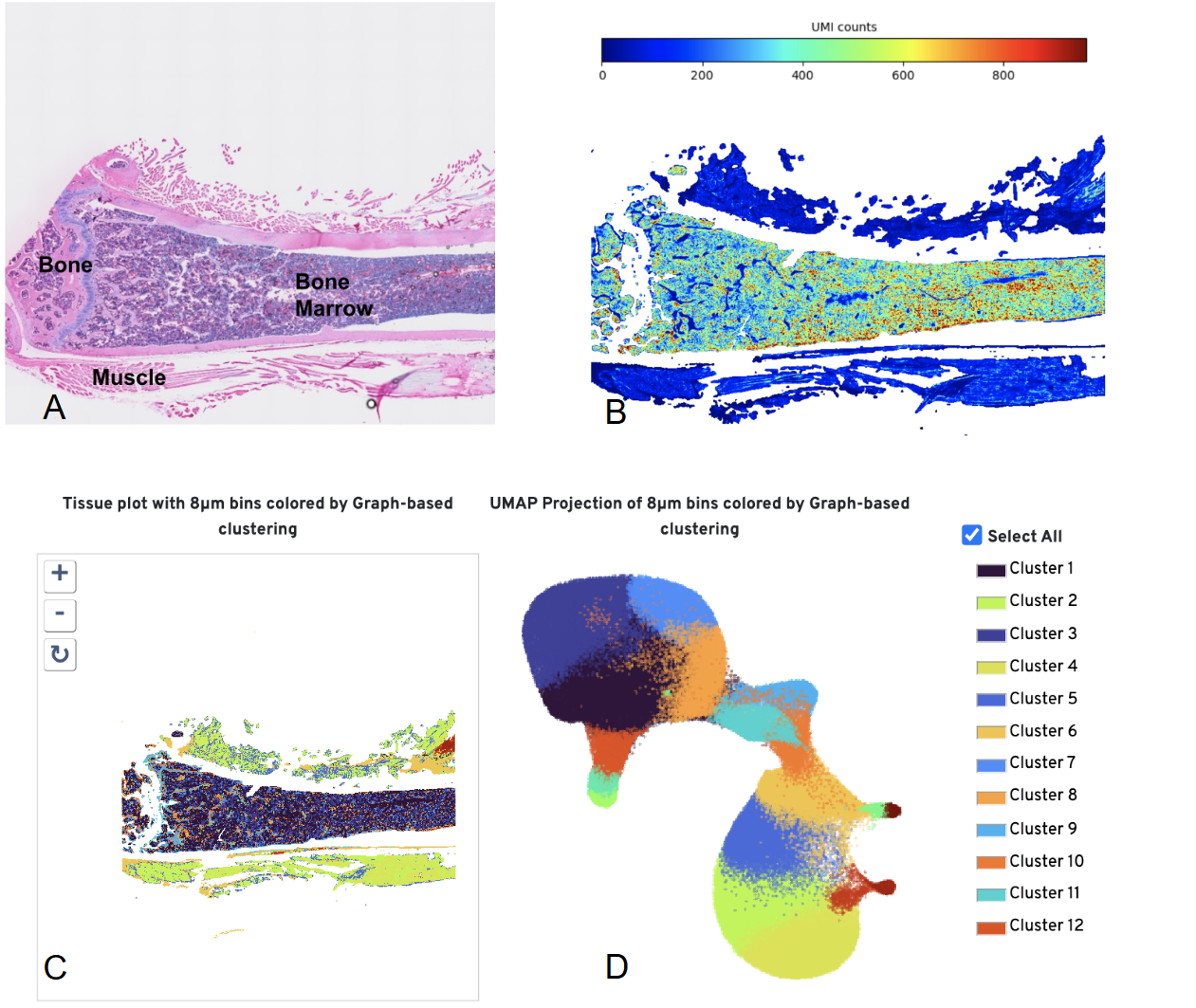 Are healthy bone FFPE tissues compatible with Visium HD Spatial Gene ...